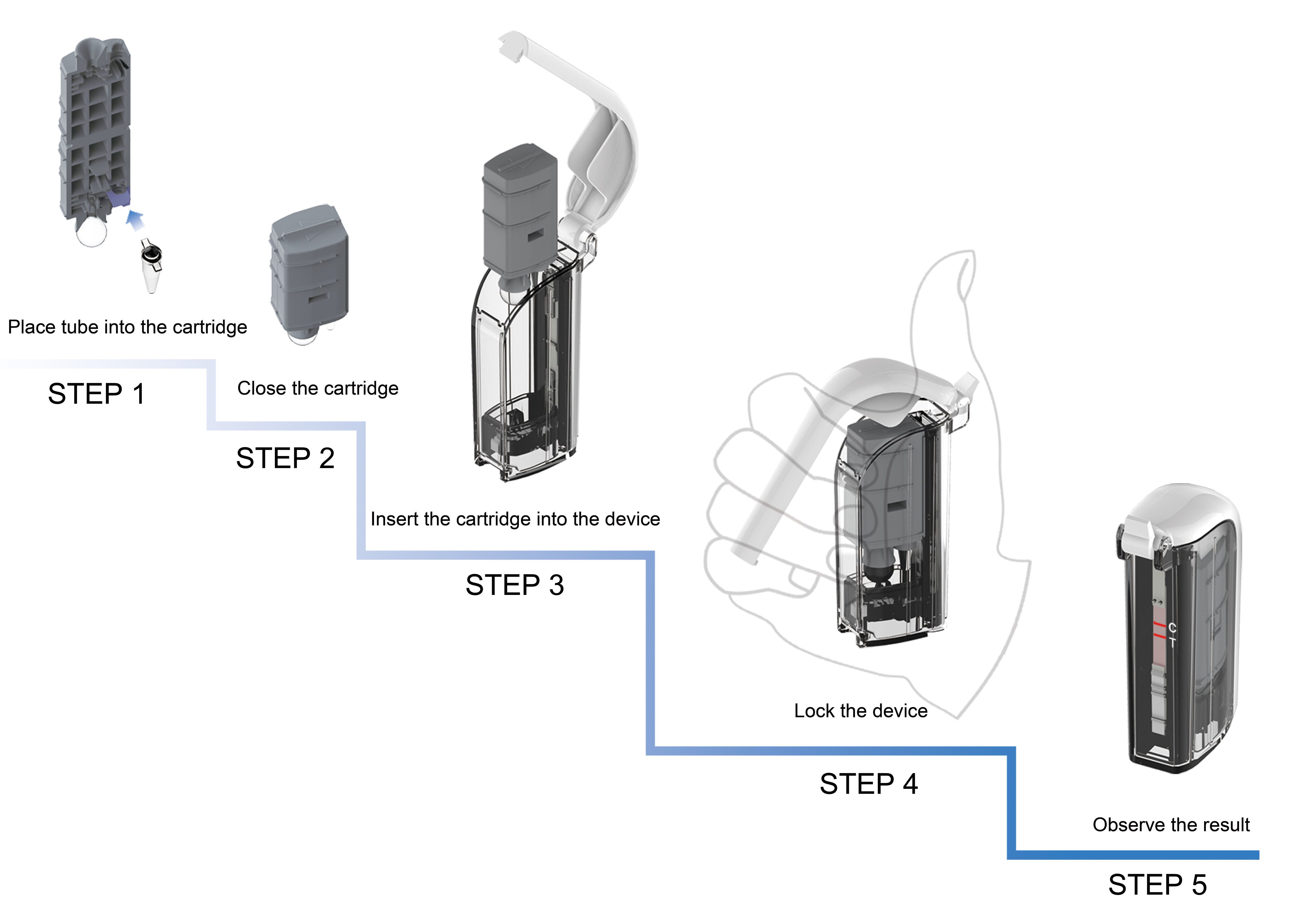 iF Design - EasyNAT TB CPA Kit